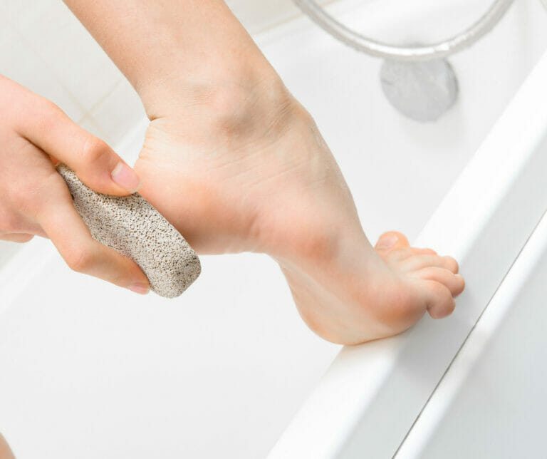 Skin: Athlete's Foot (Tinea Pedis) - 26 Foot & Ankle