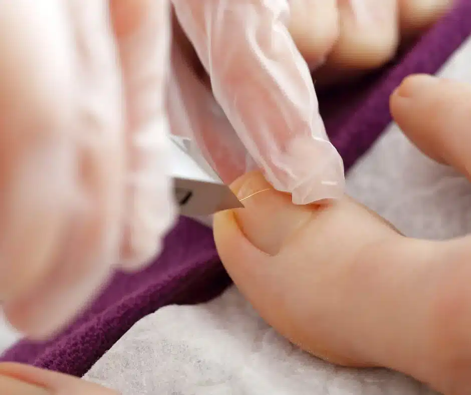 Diagnostic Studies: Biopsy: Toenail - 26 Foot & Ankle