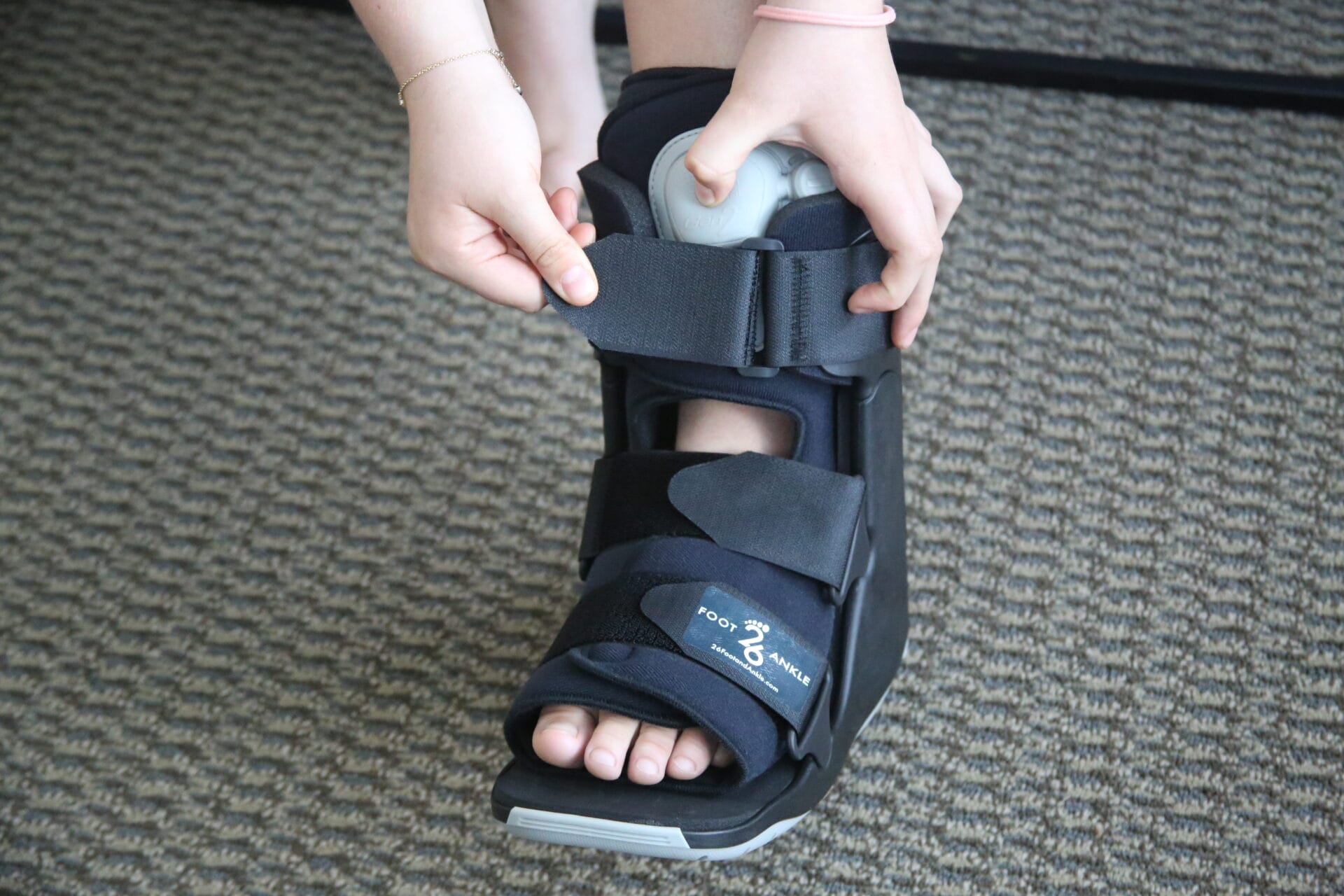 Understanding Traditional Bunion Surgery: A Step-By-Step Guide - 26 ...